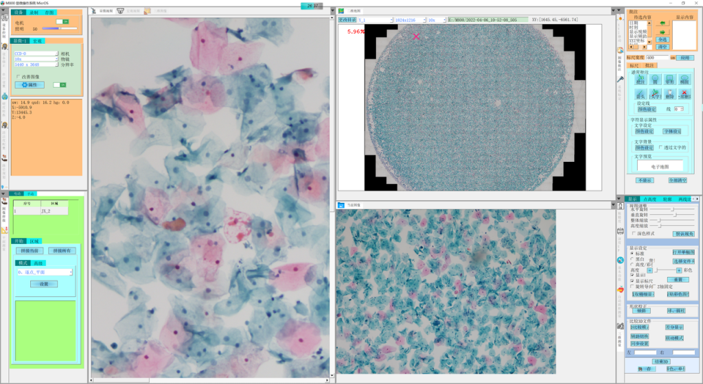 Cervical Cancer Positive Cell Slice Scanning, Stitching&Identification